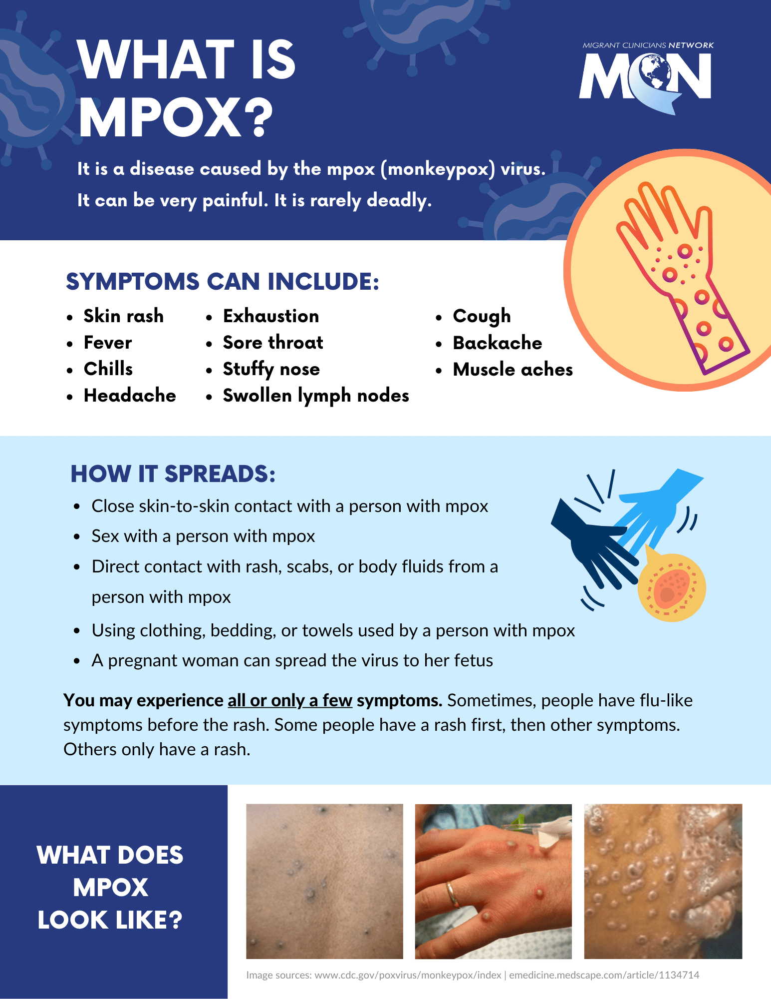 MPOX: Understanding the Risks and Protecting Your Workplace ...